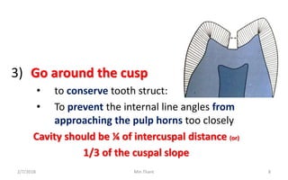 General rules for Cavity Preparations | PPT