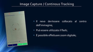 Presentazione Tesi di Laurea Magistrale - NAEVUS | PPT