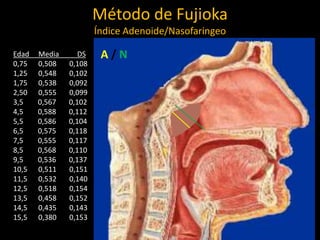 EVALUACIÓN RINOFARINGEA EN TELERADIOGRAFÍA LATERAL DE CRANEO | PPTX