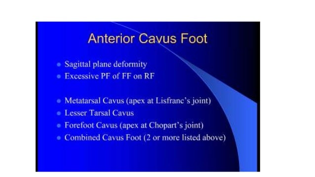 Cavus foot