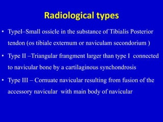 Flat foot and Cavus foot | PPTX