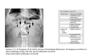 SMALL BOWELL OBSTRUCTION IN VIRGIN ABDOMEN.pptx