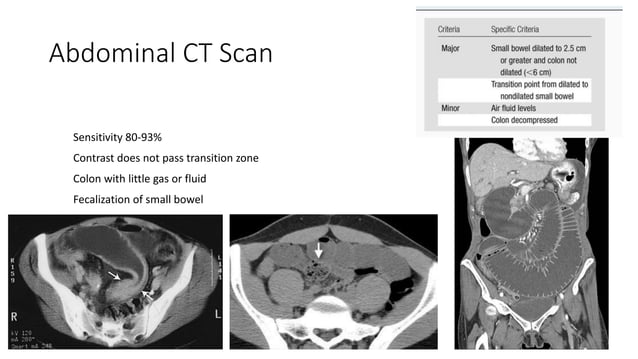 SMALL BOWELL OBSTRUCTION IN VIRGIN ABDOMEN.pptx