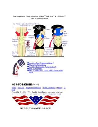 Stealth knee brace brochure | DOCX