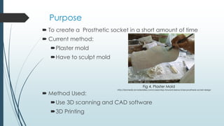 Final PowerPoint for prosthetic socket | PPTX