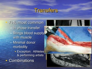 Operative Management of Achilles Tendon Disorders | PPT