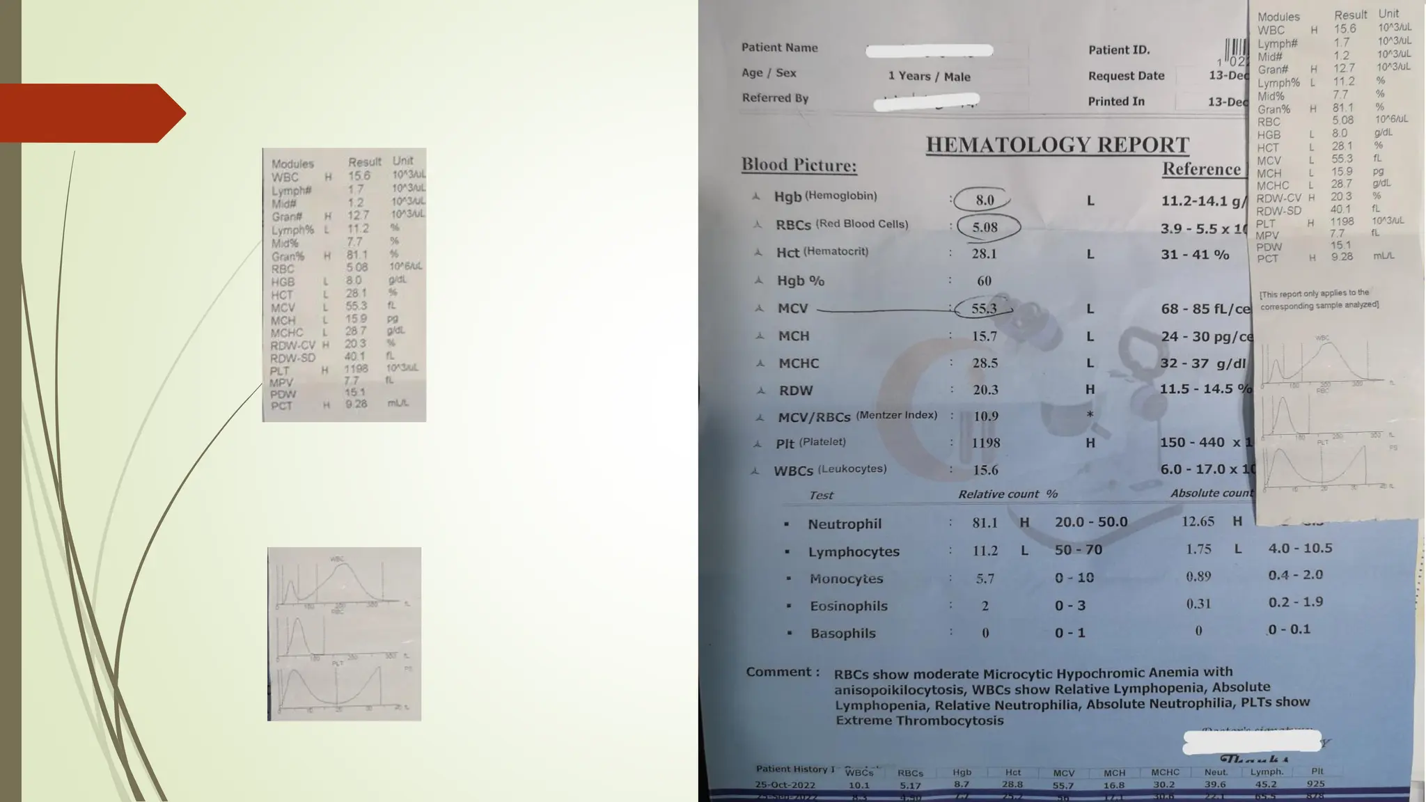 complete blood count analysis and blood disease investigation | PDF