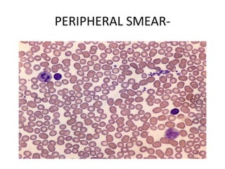 Complete blood count analysis Dr Rahul Jain & Dr Sharda Jain | PPT
