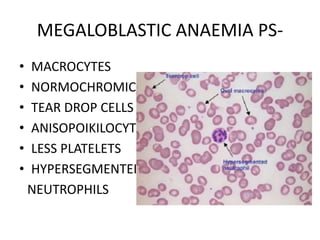 Complete blood count analysis Dr Rahul Jain & Dr Sharda Jain | PPTX
