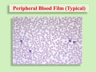 CBC Counter Basic.pdf