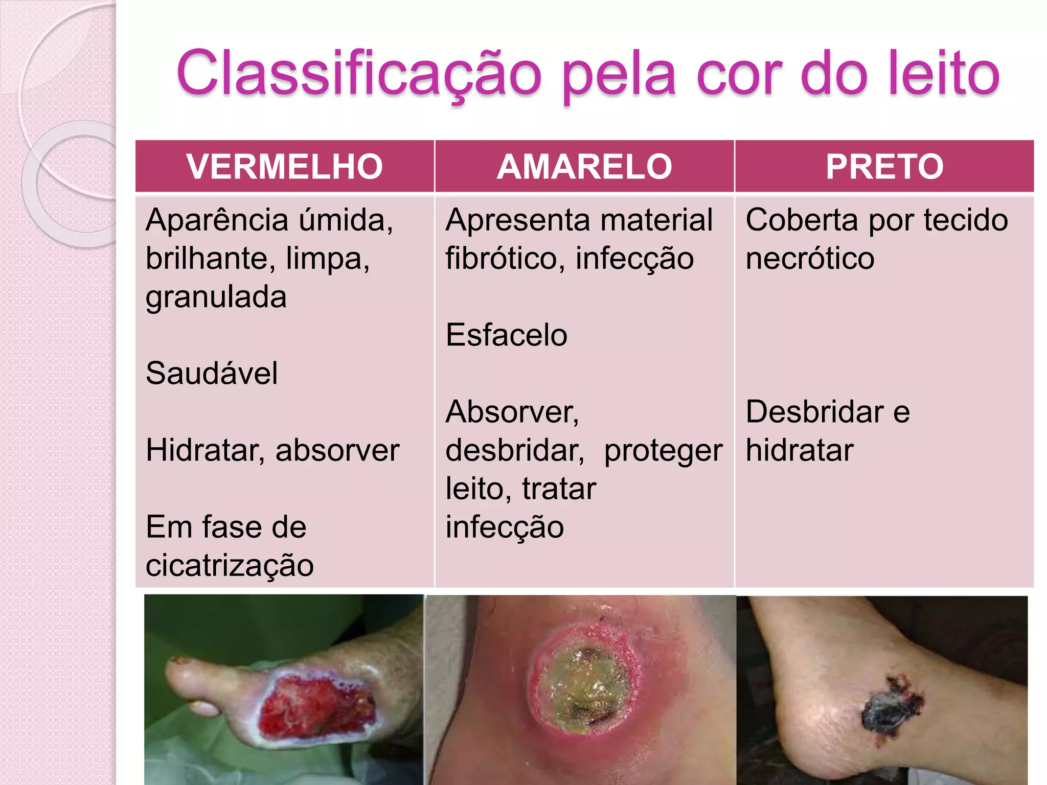 Avaliação e tratamento de feridas - CBCENF | PPTX | Injuries | Diseases ...