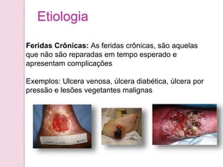 Avaliação e tratamento de feridas - CBCENF | PPTX