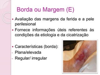 Avaliação e tratamento de feridas - CBCENF | PPT