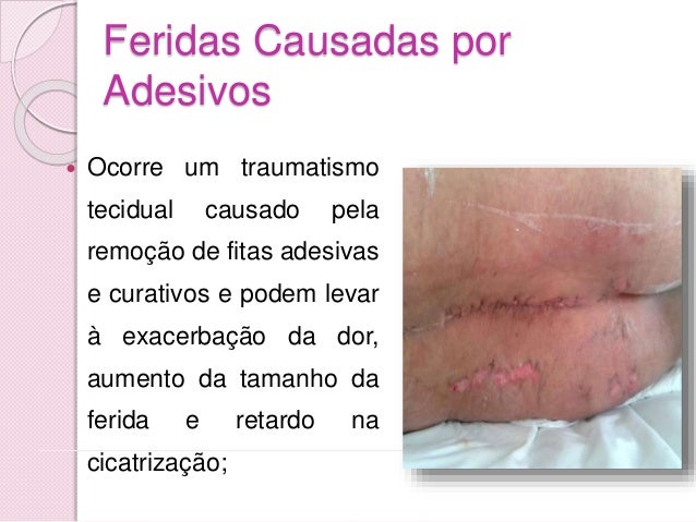 Avaliação e tratamento de feridas - CBCENF