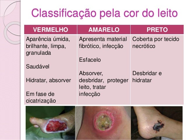 Avaliação e tratamento de feridas - CBCENF