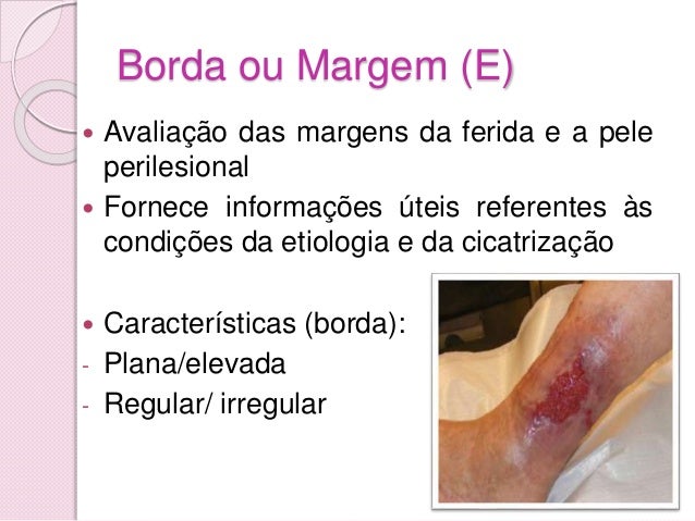 Avaliação e tratamento de feridas - CBCENF