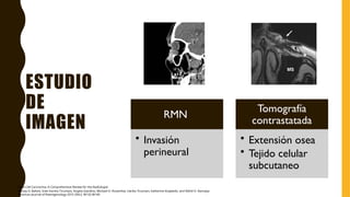 carcinoma basocelular generalidades y abordaje | PPTX