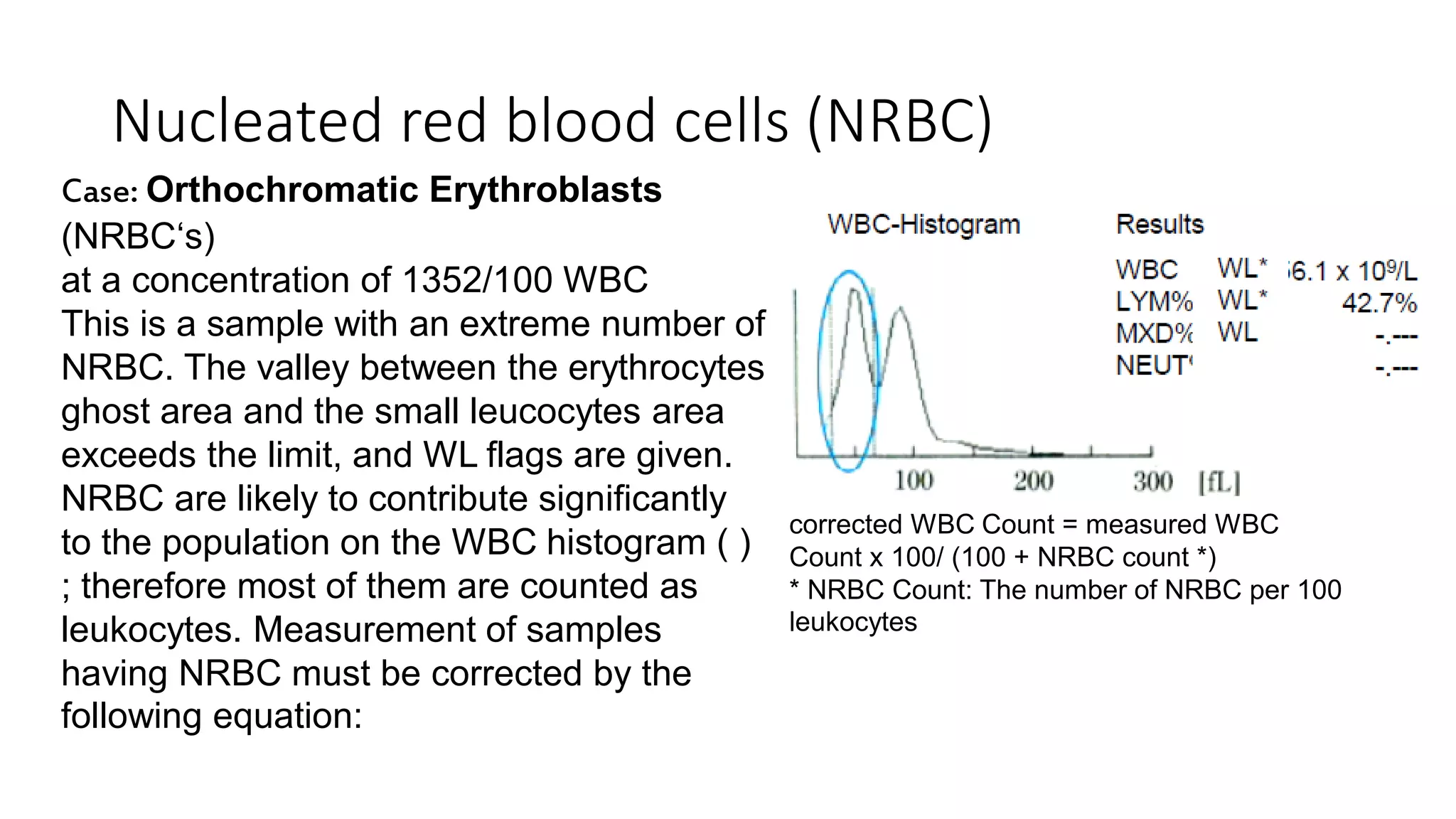 cbc histogram.pdf