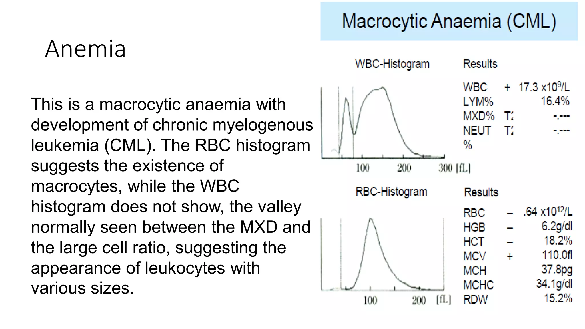cbc histogram.pdf