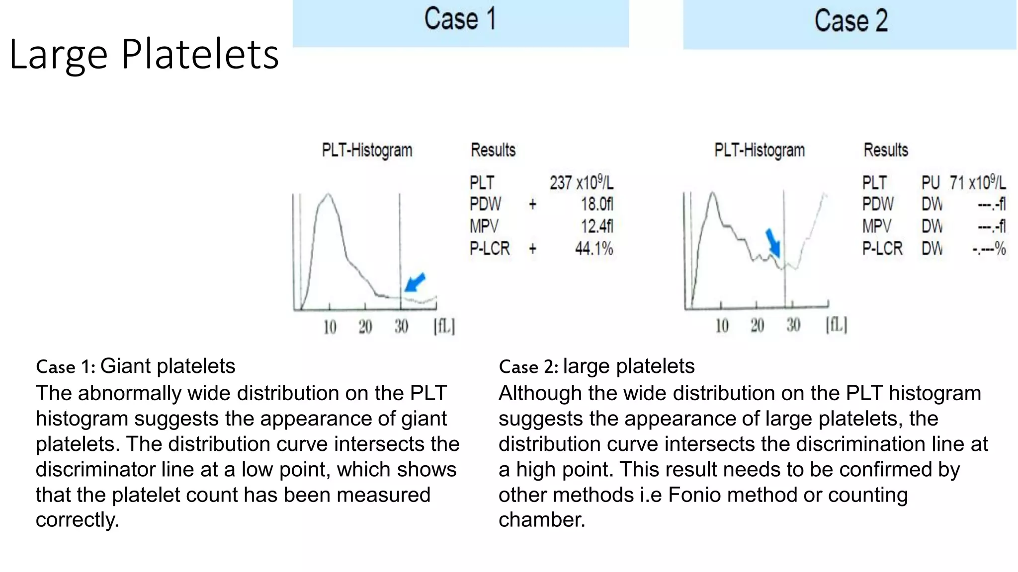 cbc histogram.pdf