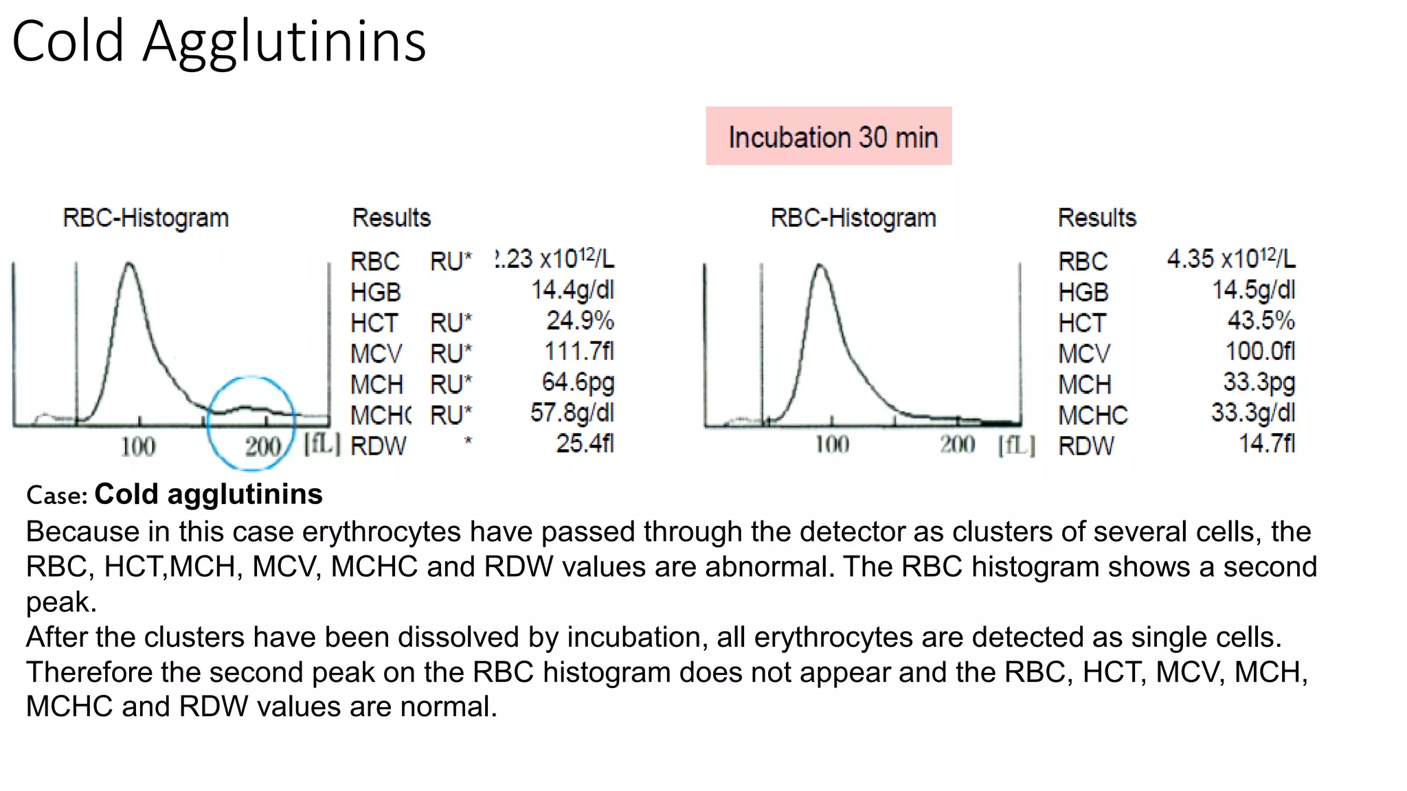 cbc histogram.pdf