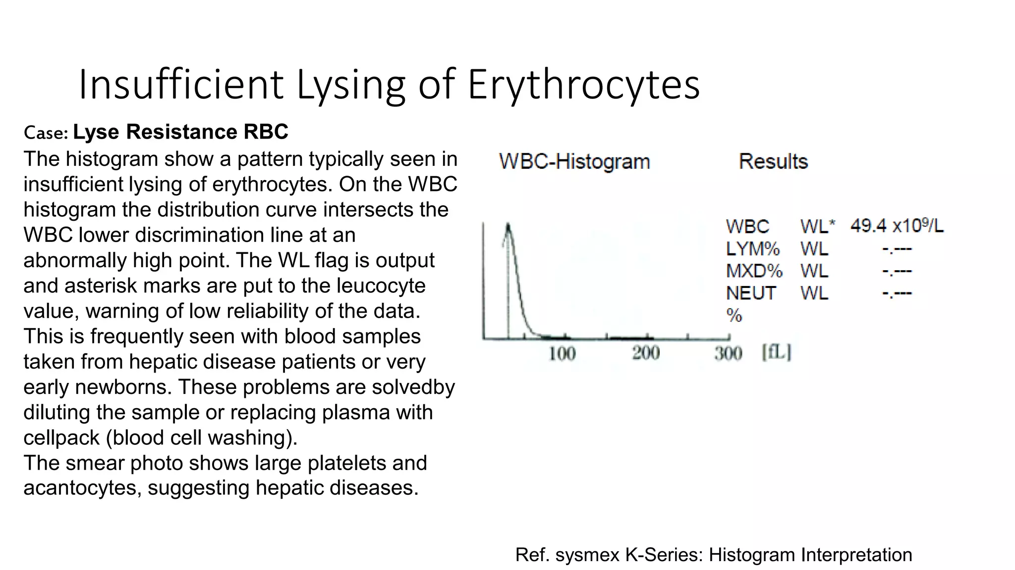 cbc histogram.pdf