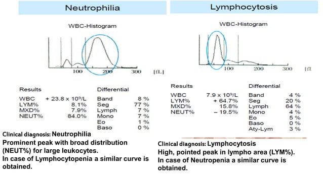 cbc histogram.pdf | Blood Disorders | Diseases and Conditions
