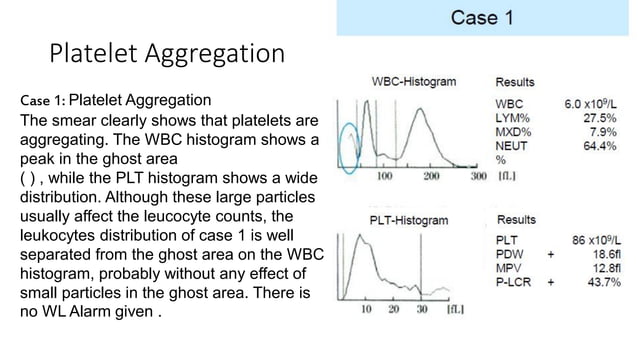 cbc histogram.pdf | Blood Disorders | Diseases and Conditions