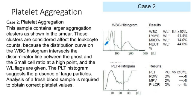 cbc histogram.pdf | Blood Disorders | Diseases and Conditions