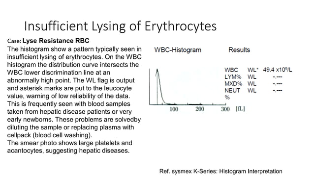 cbc histogram.pdf | Blood Disorders | Diseases and Conditions