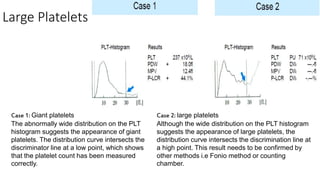 cbc histogram.pdf