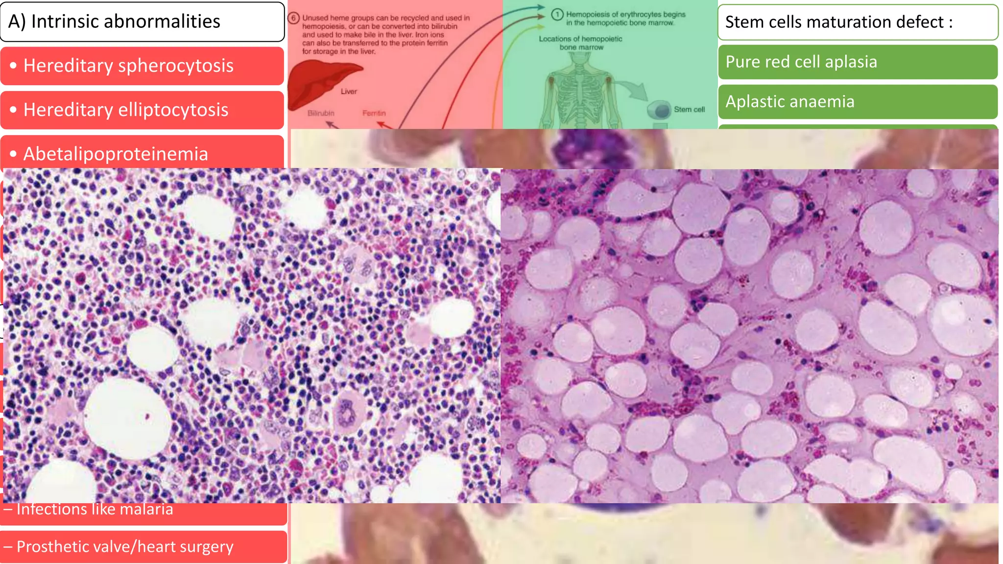 Complete Blood Count Interpretation | PPTX