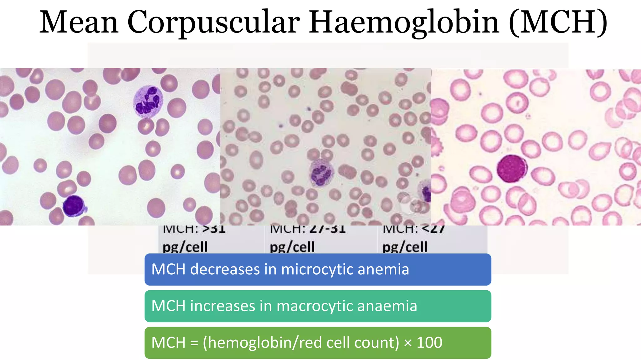 Complete Blood Count Interpretation | PPTX