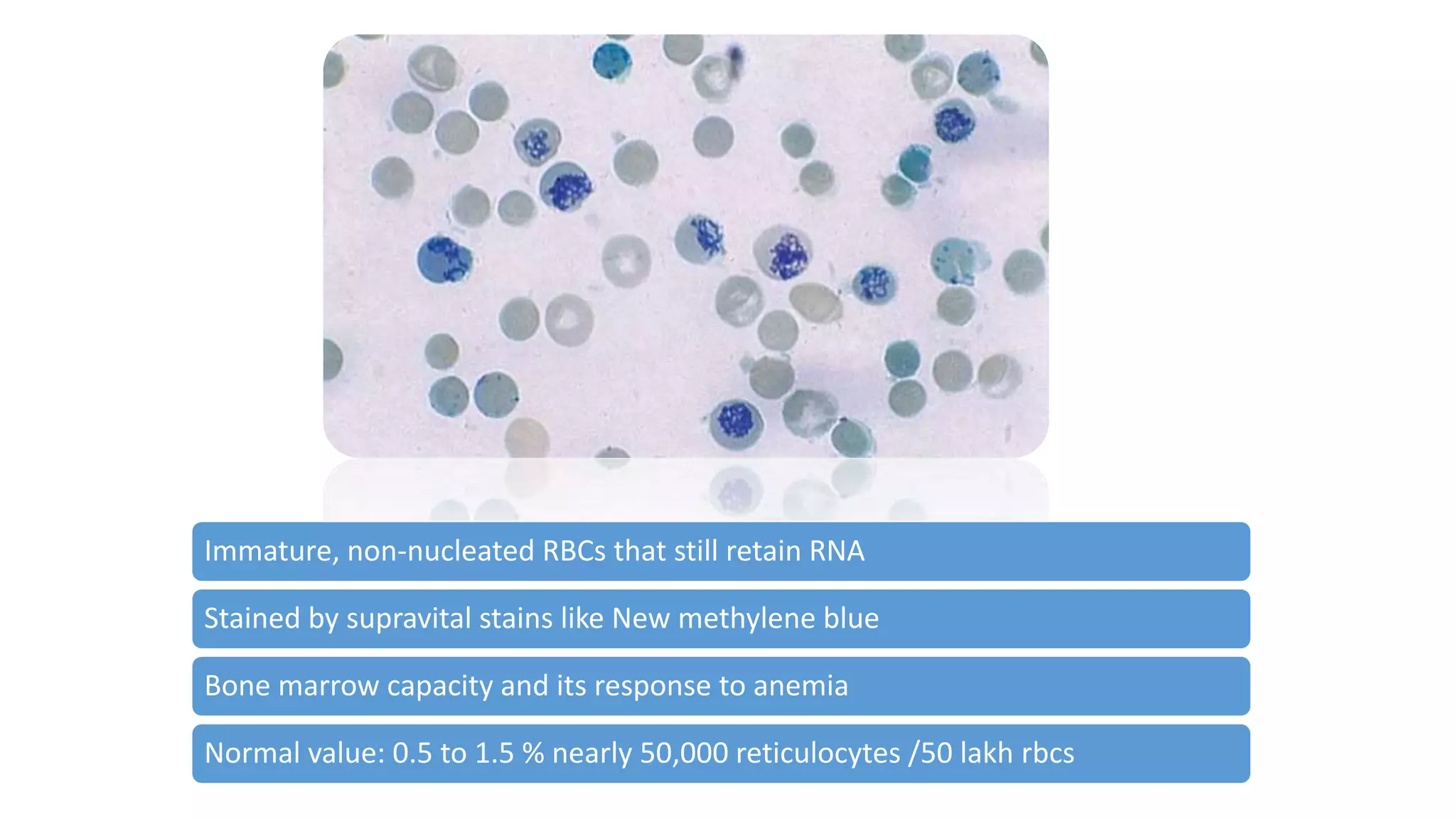 Complete Blood Count Interpretation | PPTX