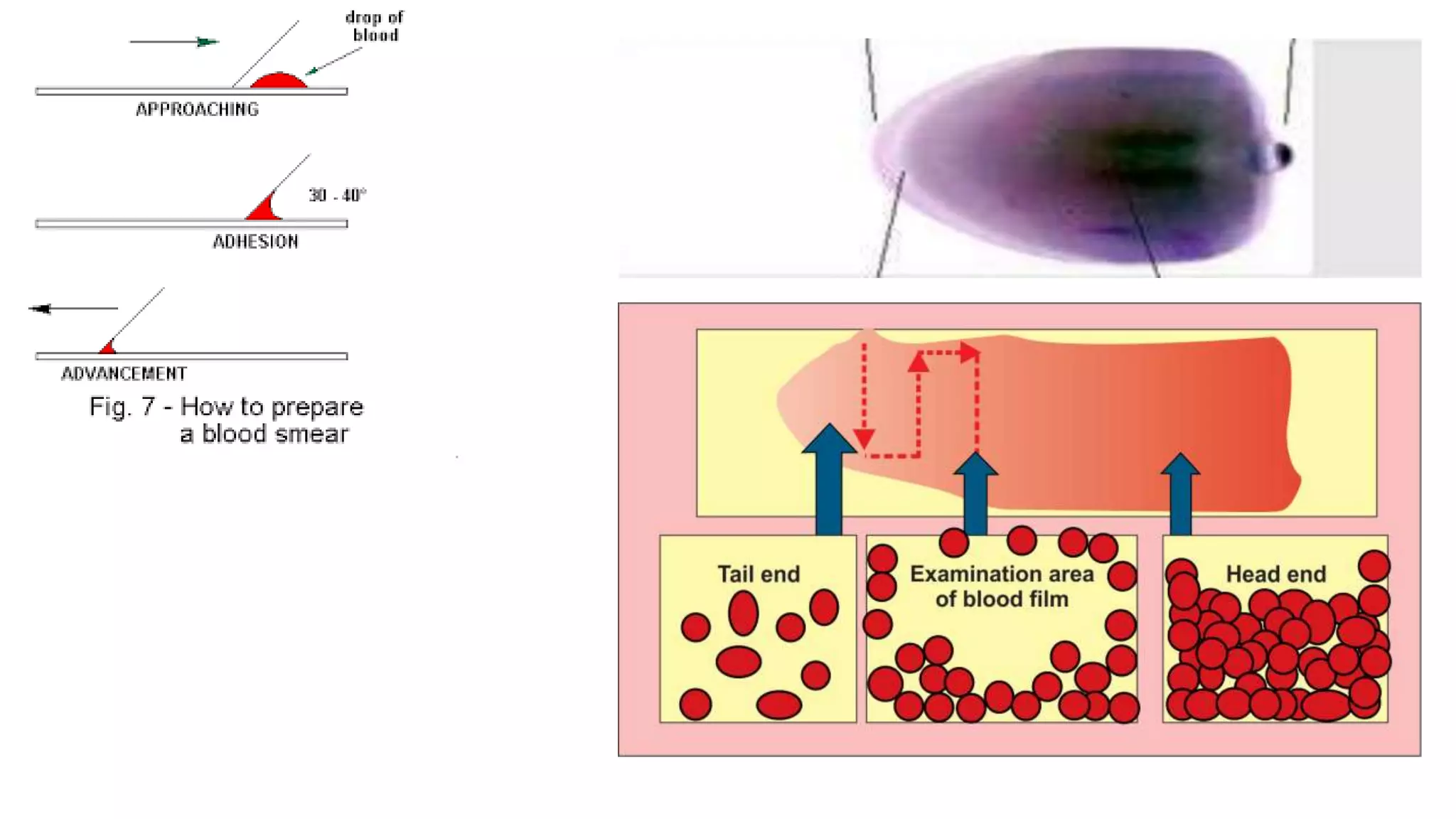 Complete Blood Count Interpretation | PPTX