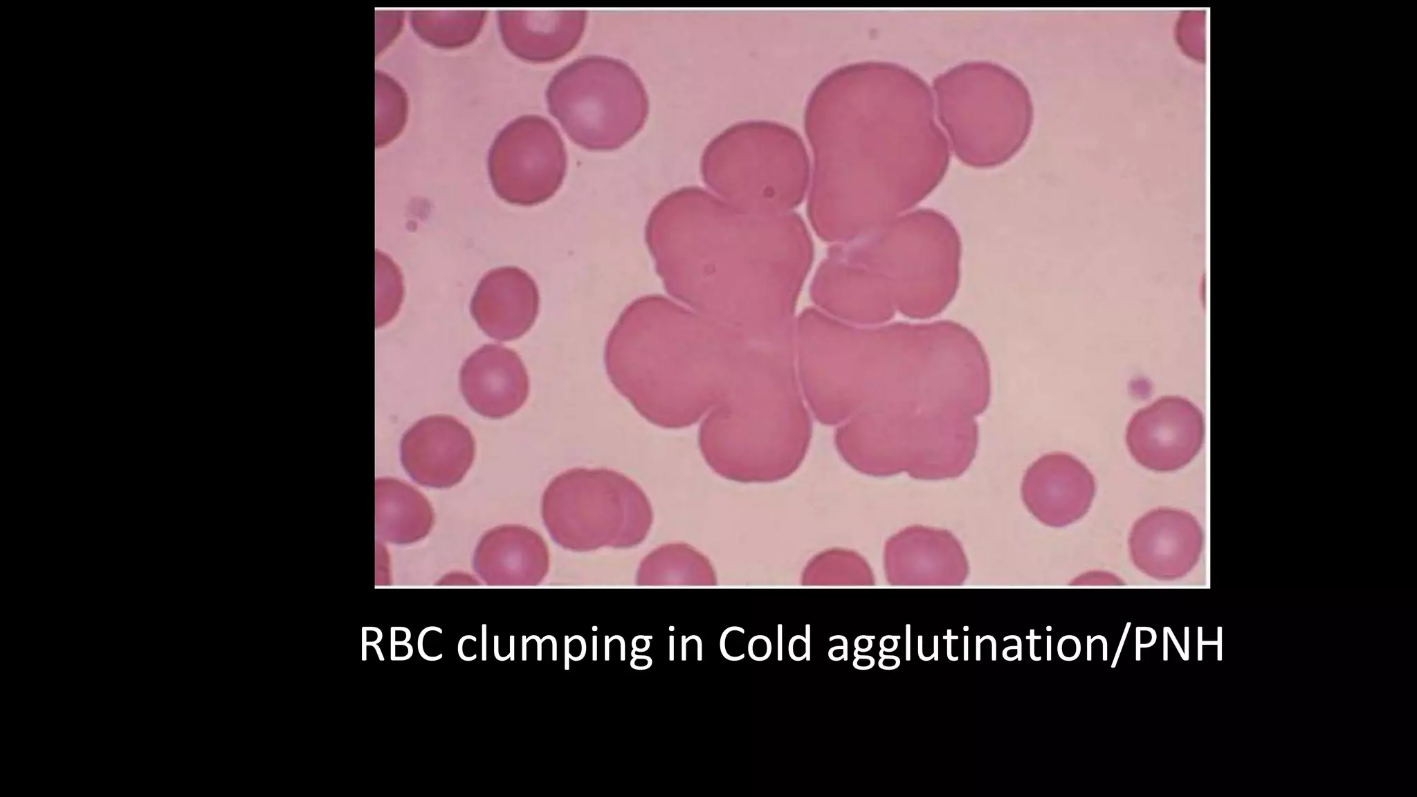 Complete Blood Count Interpretation | PPTX