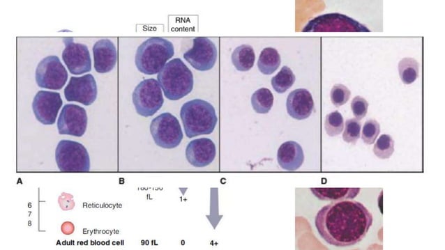 Complete Blood Count Interpretation | PPTX | Blood Disorders | Diseases ...