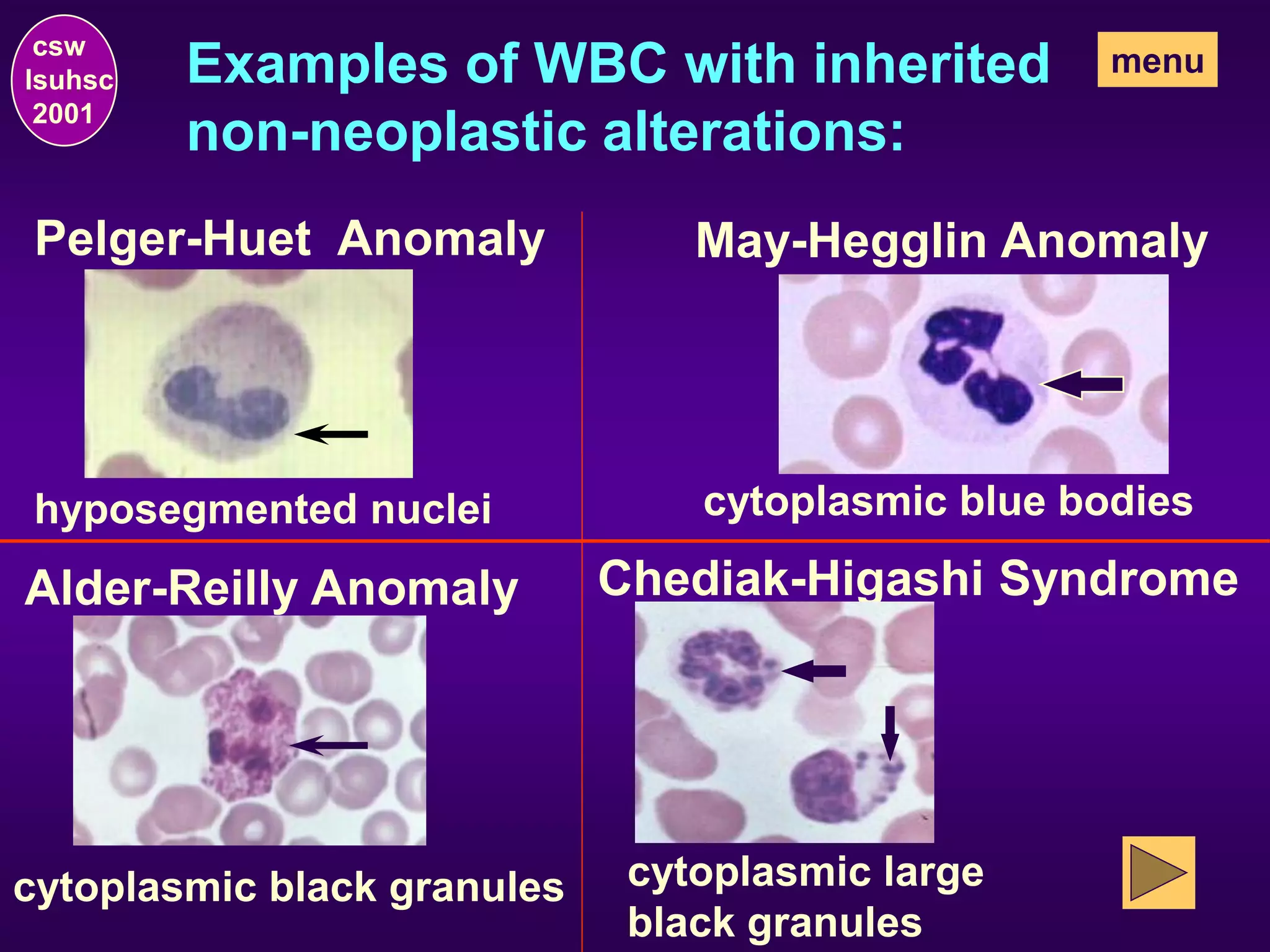 CBC Part 2 - WBC Differential & Morphology.pdf