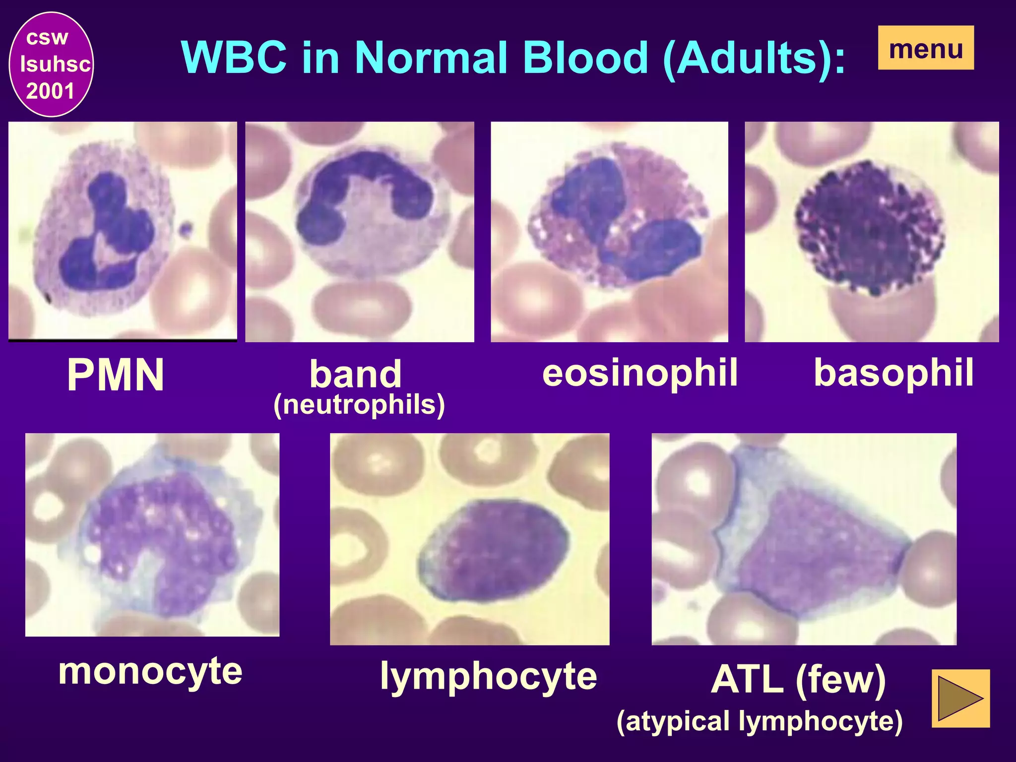 CBC Part 2 - WBC Differential & Morphology.pdf | Blood Disorders | Diseases and Conditions
