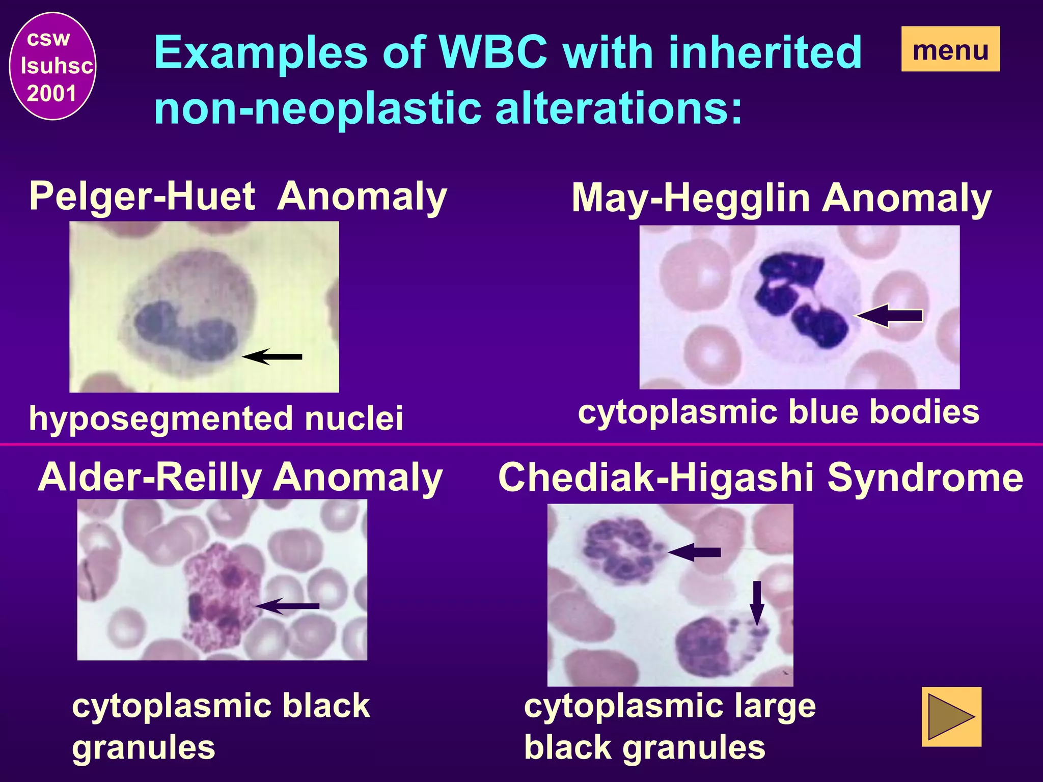 CBC Part 2 - WBC Differential & Morphology.pdf