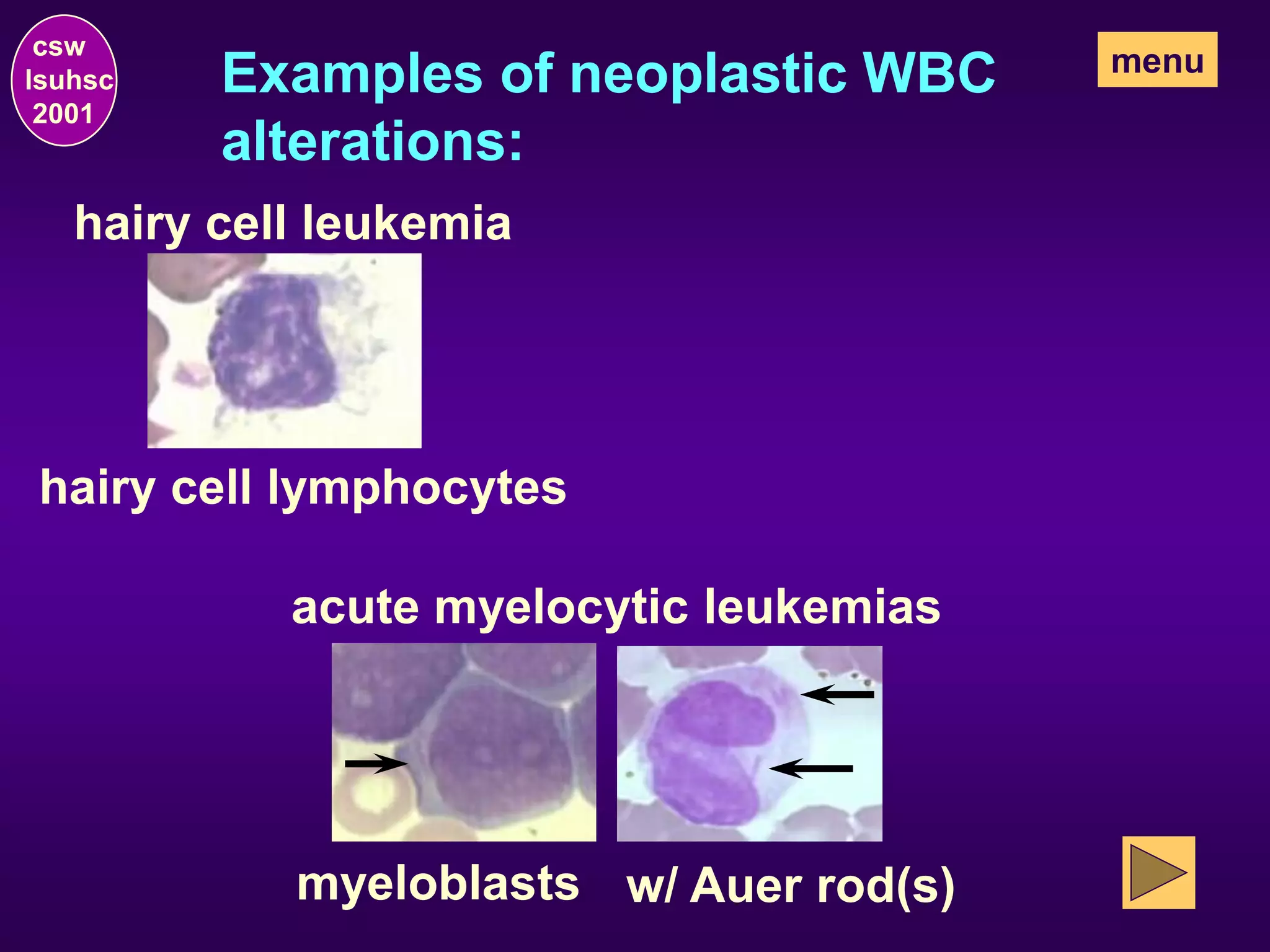 CBC Part 2 - WBC Differential & Morphology.pdf