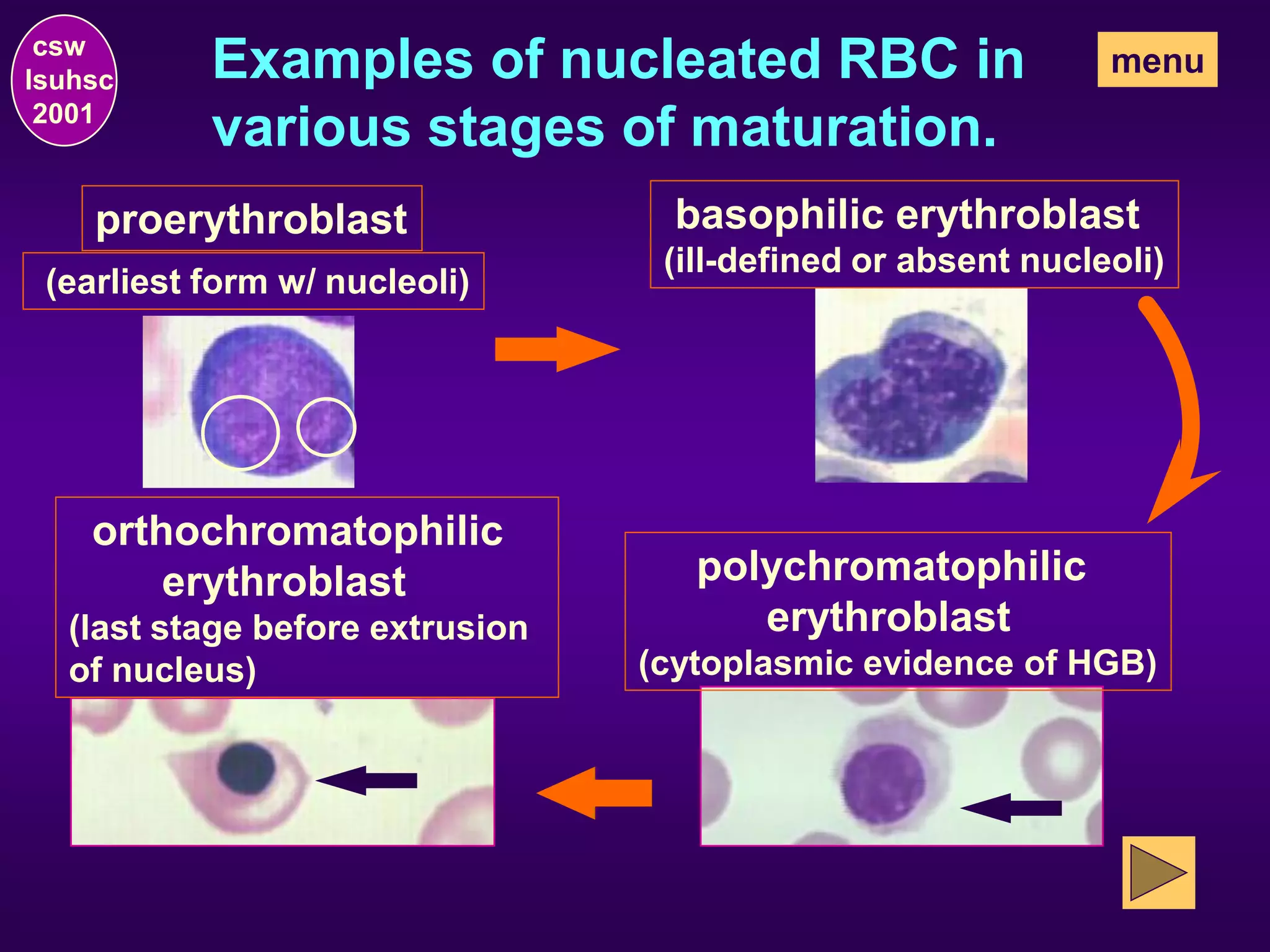 CBC Part 2 - WBC Differential & Morphology.pdf