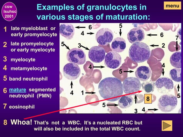 CBC Part 2 - WBC Differential & Morphology.pdf | Blood Disorders ...