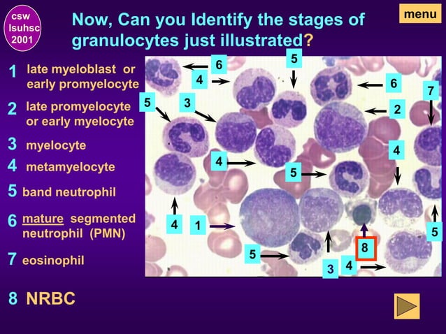CBC Part 2 - WBC Differential & Morphology.pdf | Blood Disorders ...