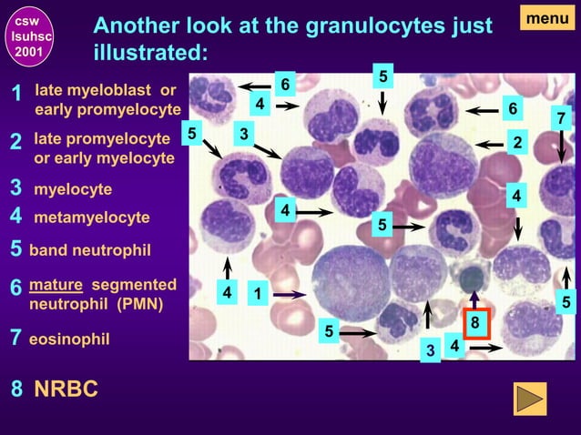 CBC Part 2 - WBC Differential & Morphology.pdf | Blood Disorders ...