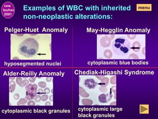CBC Part 2 - WBC Differential & Morphology.pdf