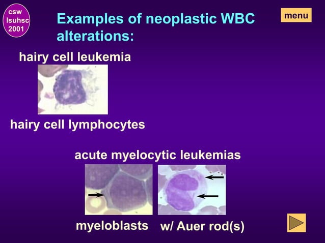 CBC Part 2 - WBC Differential & Morphology.pdf | Blood Disorders ...