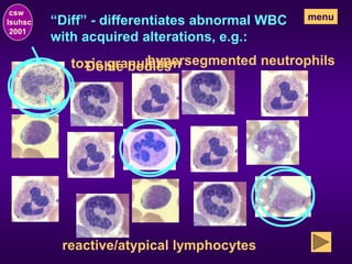 CBC Part 2 - WBC Differential & Morphology.pdf