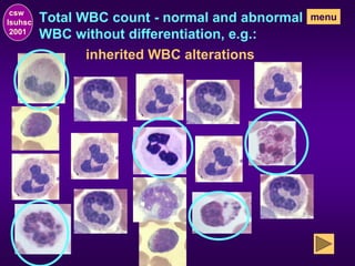 CBC Part 2 - WBC Differential & Morphology.pdf