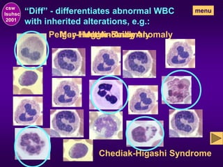 CBC Part 2 - WBC Differential & Morphology.pdf